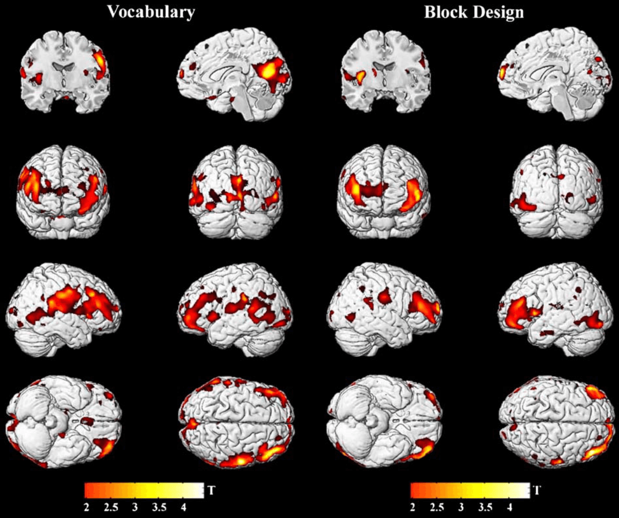 A Comprehensive History of IQ Tests | Riot IQ